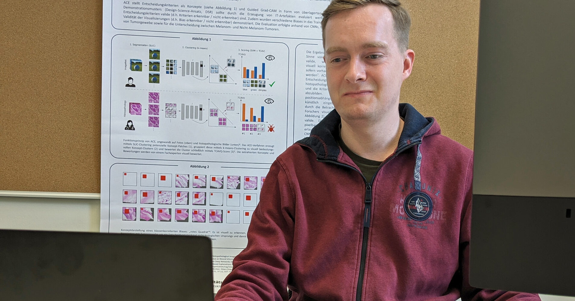 Can we trust AI to diagnose cancer? | News from Fachhochschule Dortmund